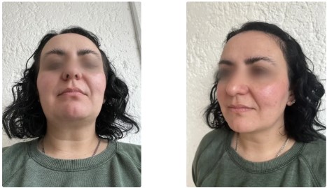 Facial Recognition: How to Train Models and Keep Improving Over Time ...