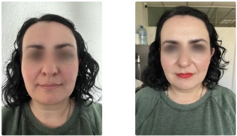 Facial Recognition: How to Train Models and Keep Improving Over Time ...